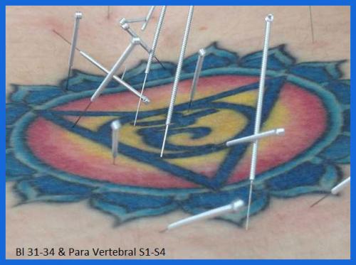 TCM Info | Acupuncture College | Training Courses | Chinese Herbal ...